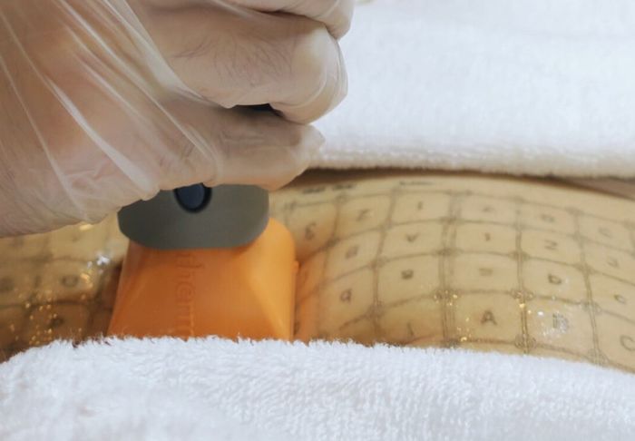 Bukan Alami, Kenali Jenis-Jenis Perawatan untuk Menghilangkan Selulit ...