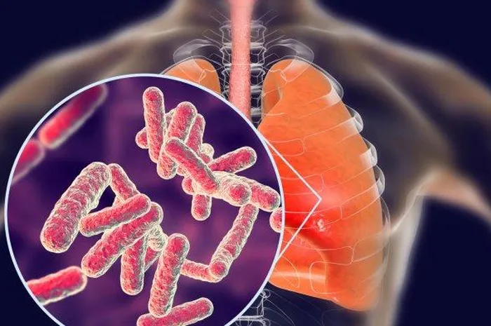 Mengenal Tuberkulosis, Bagaimana TB Menular hingga Faktor Risikonya ...