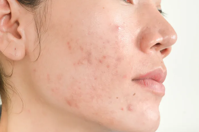 Dokter Viral di TikTok Beri Tips Berhenti Pakai Skincare Abal-Abal ...