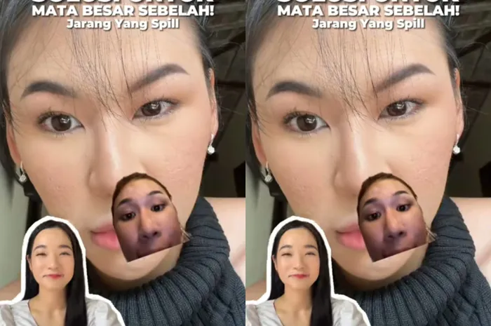 Viral di TikTok, Ini Perawatan untuk Mengatasi Mata Besar Sebelah ...