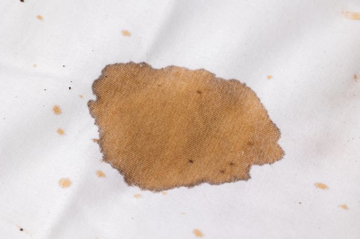 Tak Perlu Khawatir, Ini 3 Bahan Ampuh Hilangkan Noda Darah pada Pakaian - Parapuan