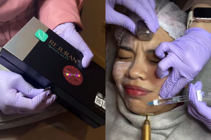 Apa itu Rejuran? Cari Tahu Manfaat Skin Booster Viral di TikTok Ini ...