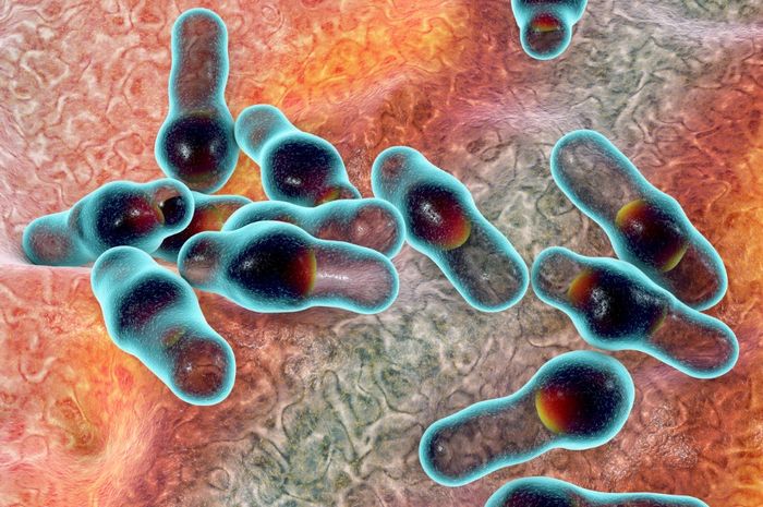 Apa Itu Tetanus? Berikut Penjelasan dan Penyebab Penyakit Satu Ini ...