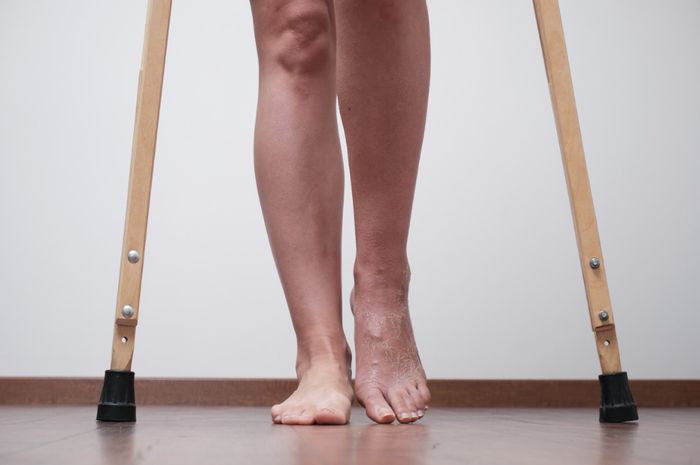 Pekerja yang WFH Berisiko Mengalami Atrofi Otot, Penyakit Apa Itu ...