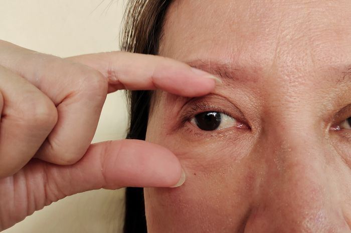 Degenerasi Makula, Gejala dan Pencegahan Gangguan Penglihatan Ini ...