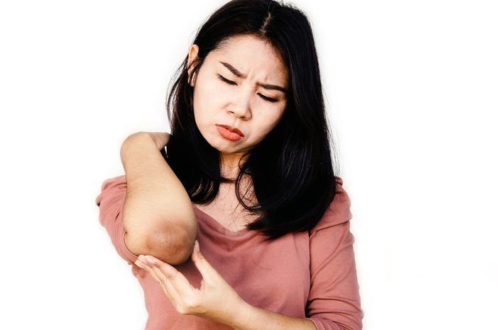 5 Bahan Alami untuk Mengatasi Siku Hitam, Bisa Pakai Minyak Kelapa ...